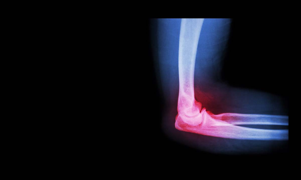 Elbow Orthopedic Resources and Reference