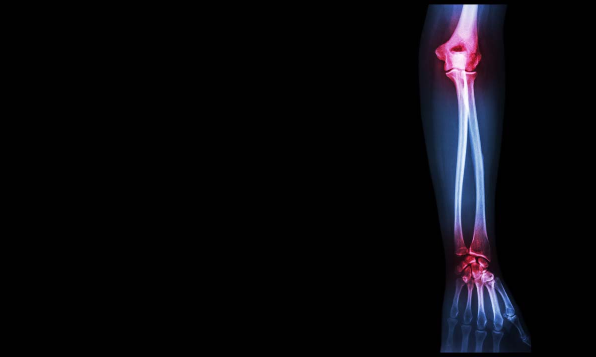 Arm Orthopedic Resources and Reference